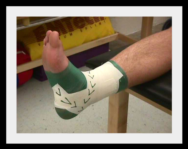 How To Tape An Ankle